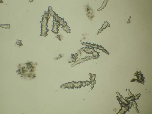 Spicule - CreationWiki, the encyclopedia of creation science